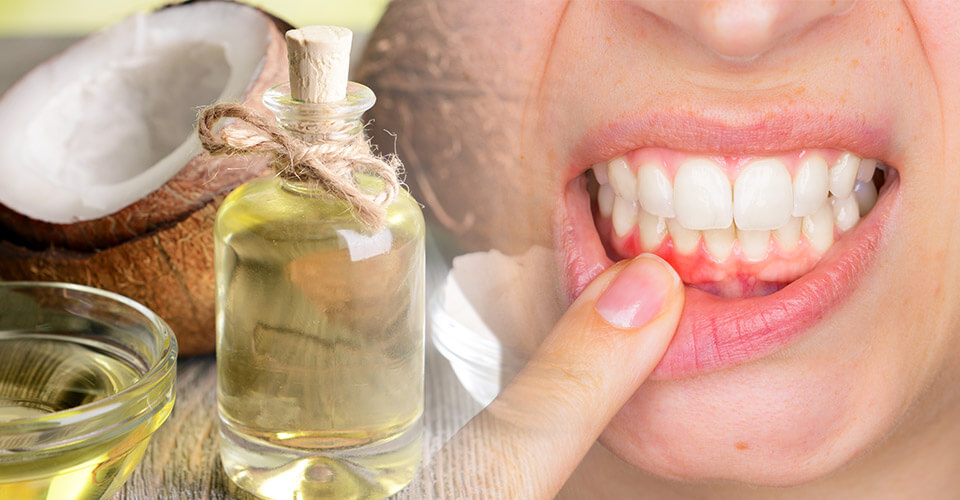 coconut-oil-pulling-benefits